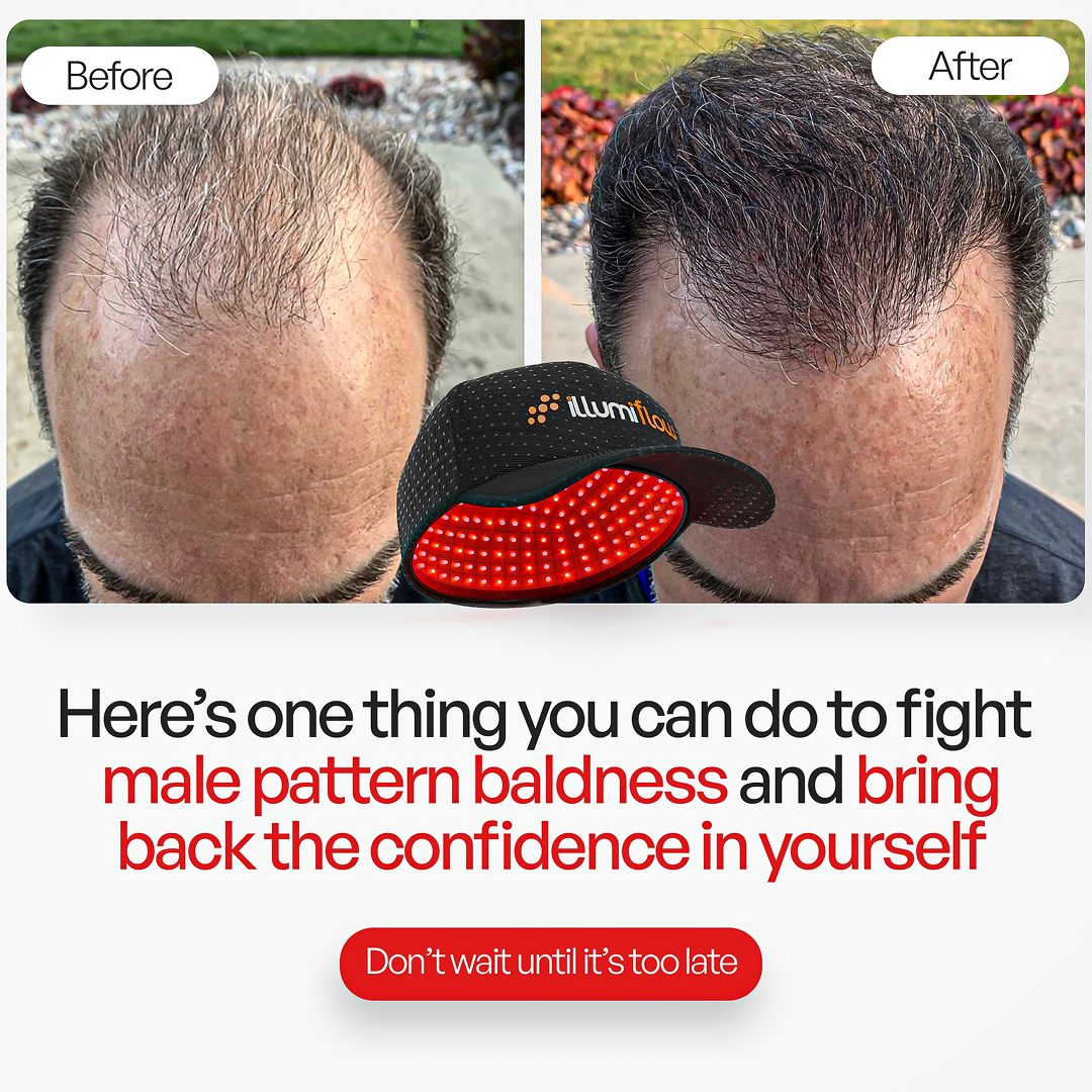 Illumiflow 272 Laser Cap For Hair Regrowth In Men And Women
