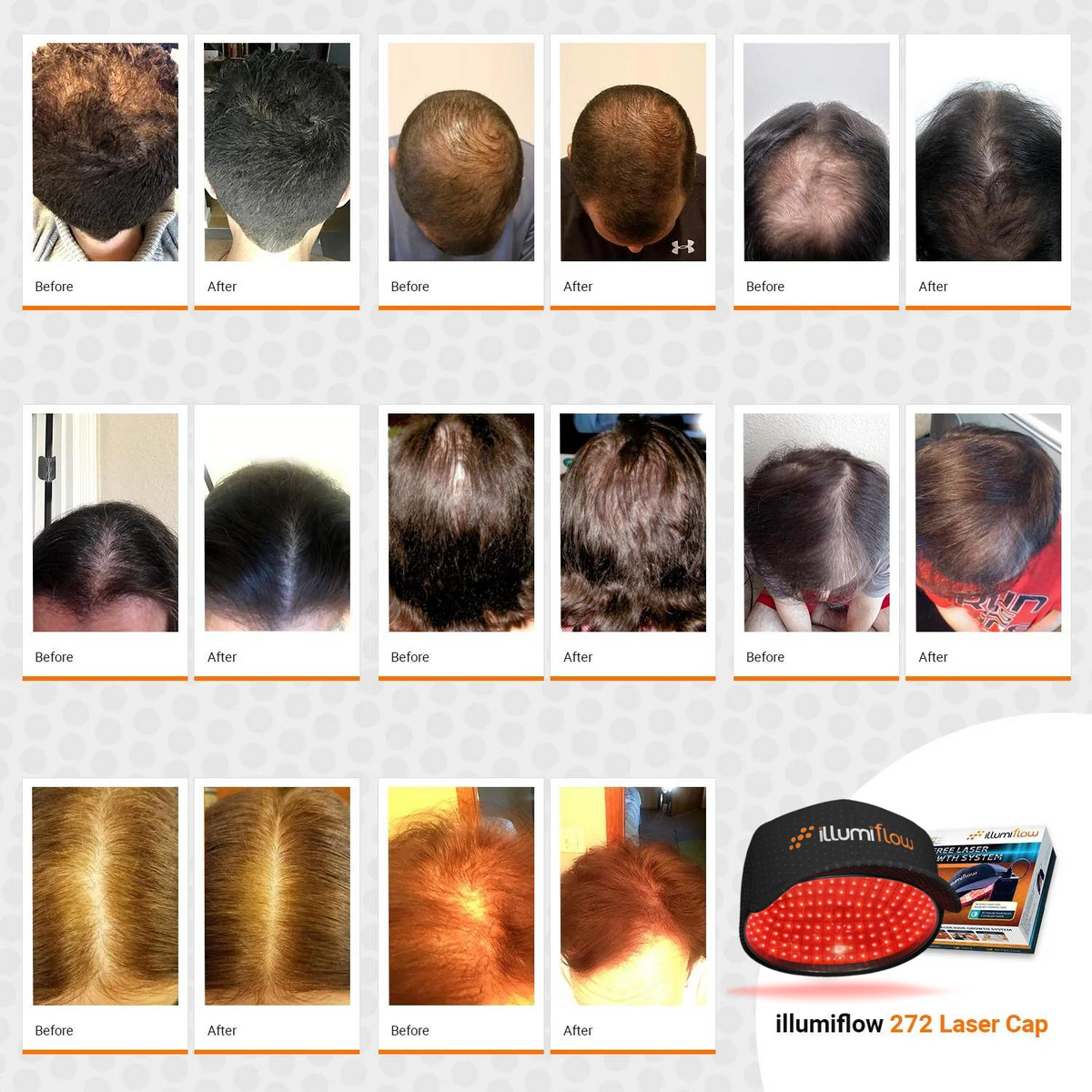 illumiflow 272 Pro Max Laser Cap for Hair Regrowth